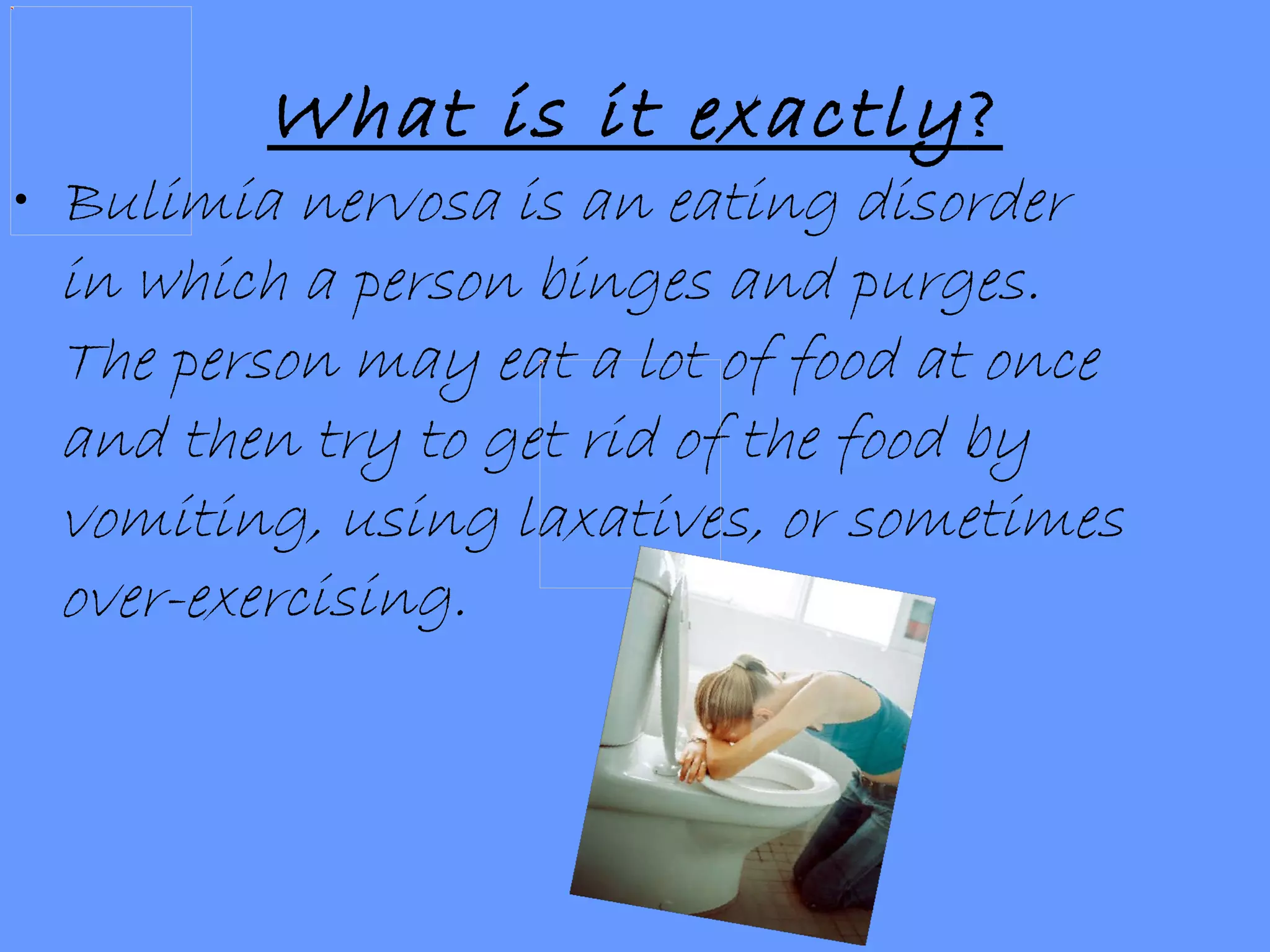 Bulimia nervosa | PPT