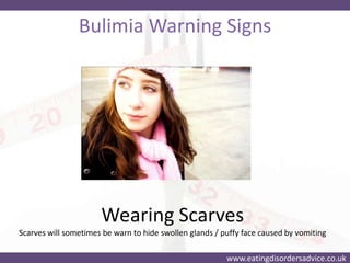 Bulimia warning signs | PDF