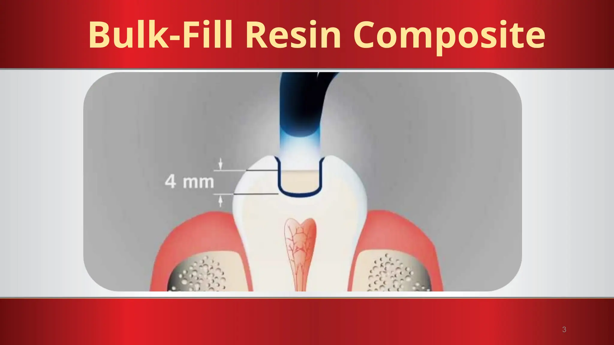 Bulk Fill Resin Composite Restoratie Materials Ppt