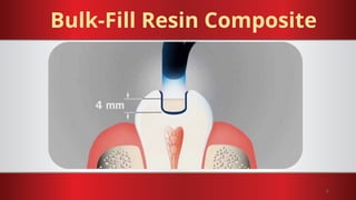 bulk fill resin composite restoratie materials.ppt