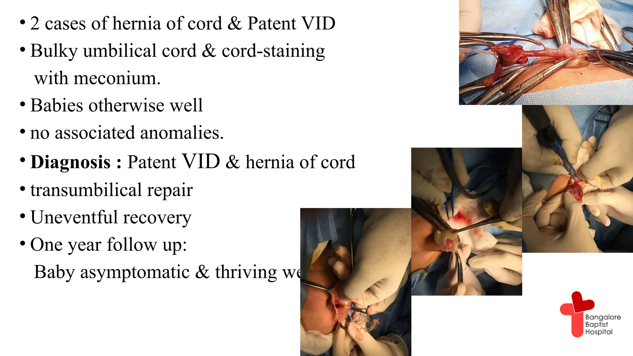 Bing Bing Bong Bong Ding Ding Dong Dong ! | PPTX
