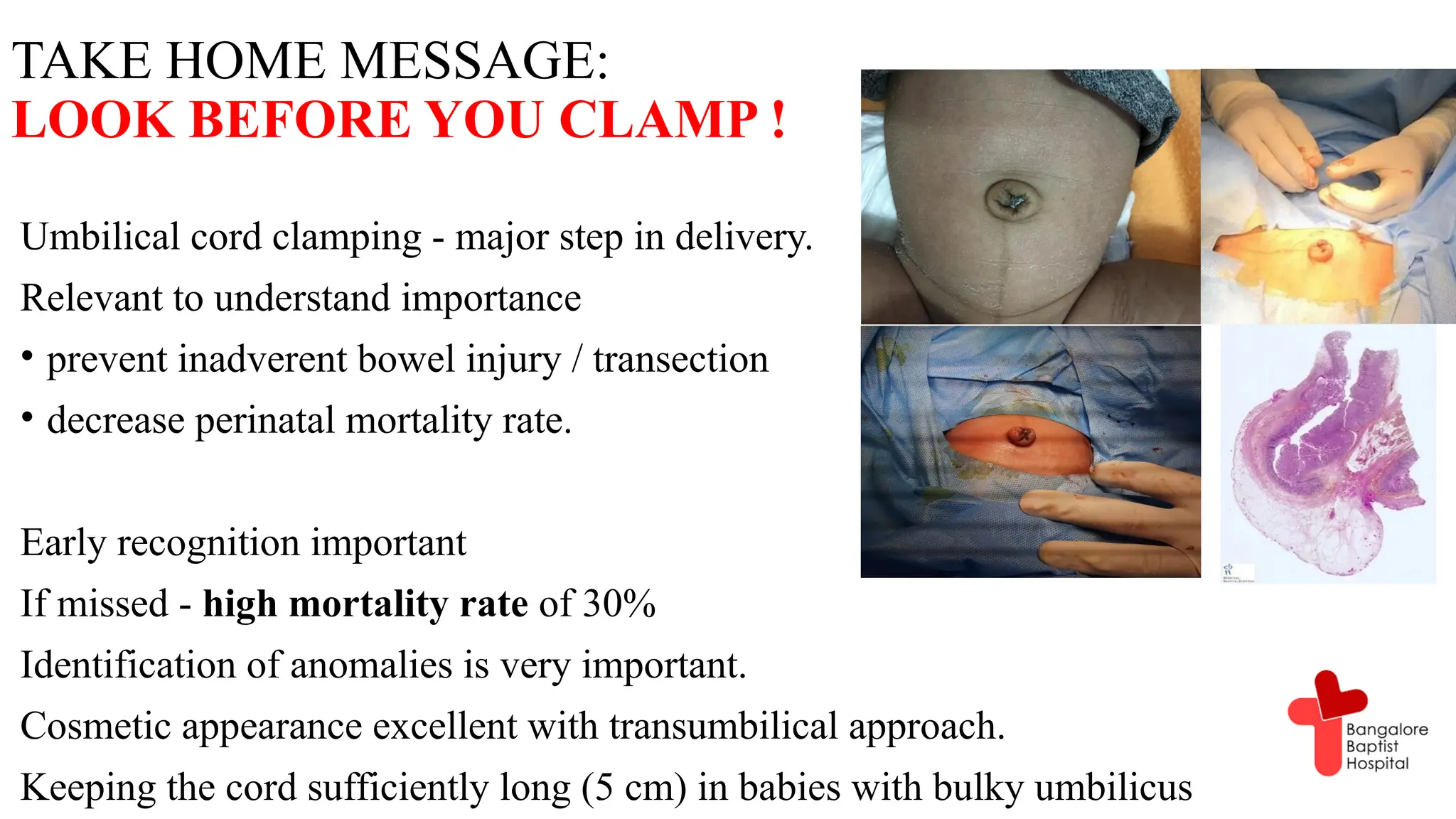 Bing Bing Bong Bong Ding Ding Dong Dong ! | PPTX