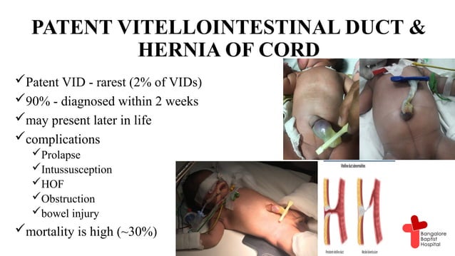 Bing Bing Bong Bong Ding Ding Dong Dong ! | PPTX