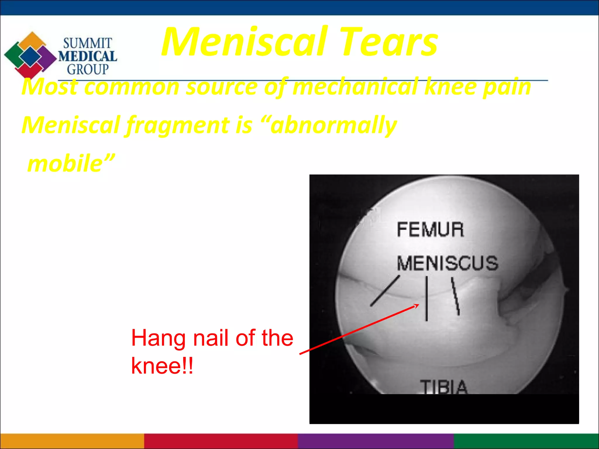 The Knee: Common Problems and Current Treatment | PPT