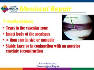 The Knee: Common Problems and Current Treatment | PPT