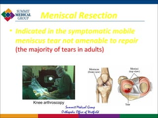 The Knee: Common Problems and Current Treatment | PPT