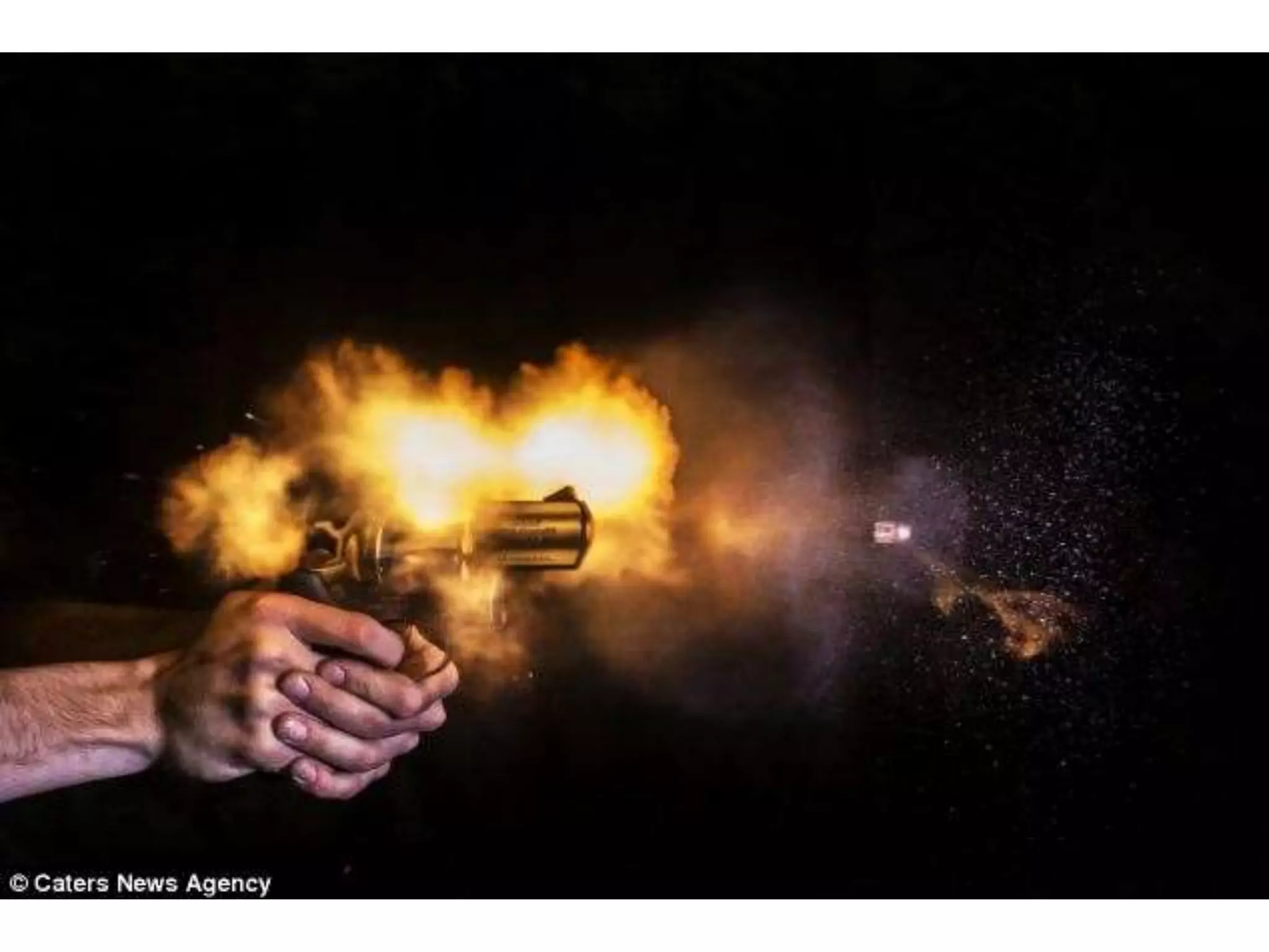 Bullet injuries explained with animation | PPTX