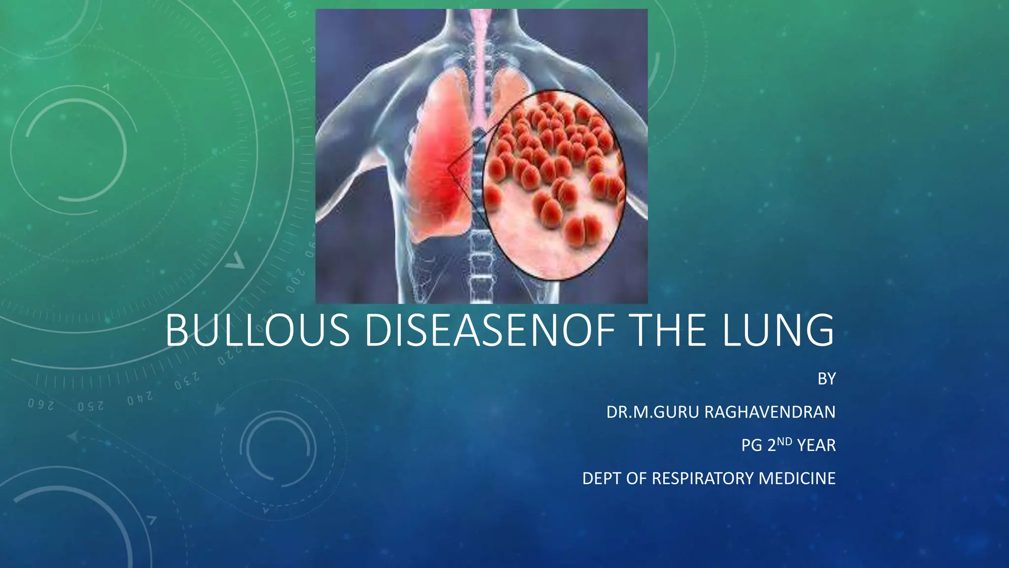 BULLOUS DISEASENOF THE LUNG.pptx high yield topic | PPTX