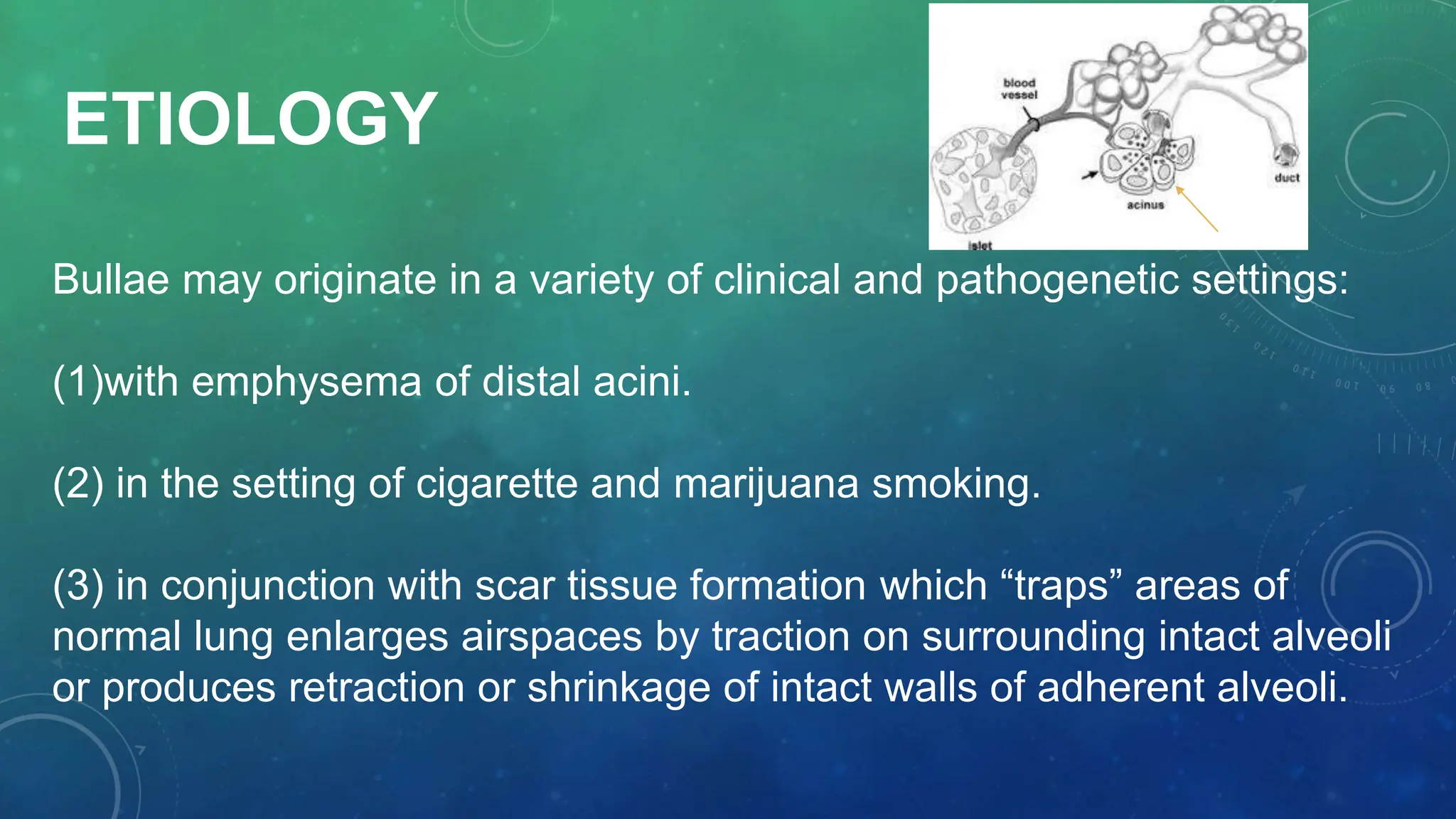 BULLOUS DISEASENOF THE LUNG.pptx high yield topic | PPTX