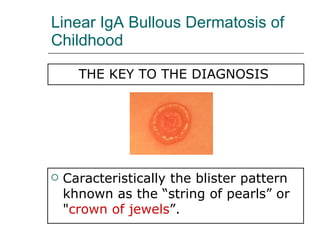 Linear IgA bullous dermatosis II | PPT