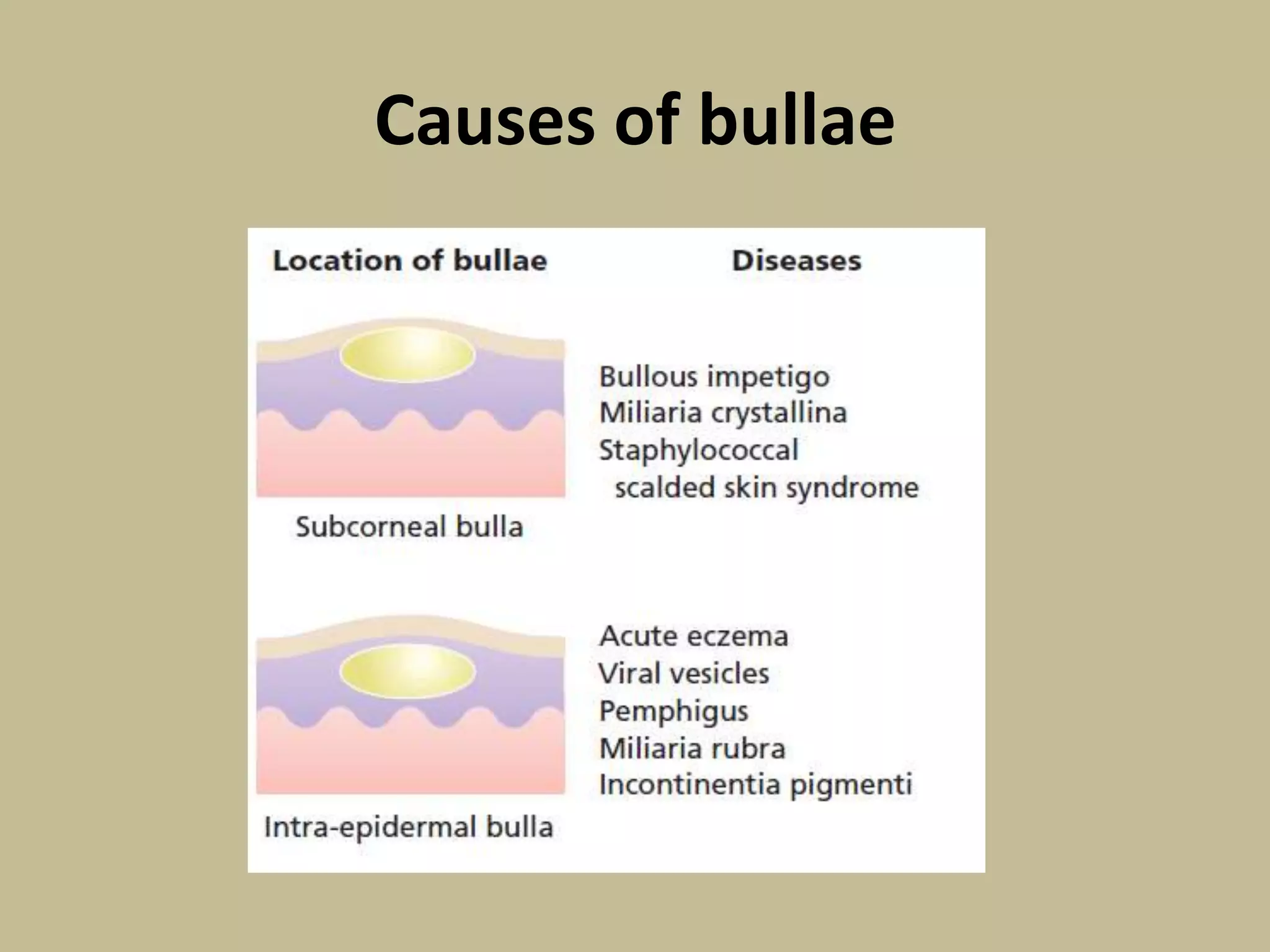 Bullous diseases | PPTX