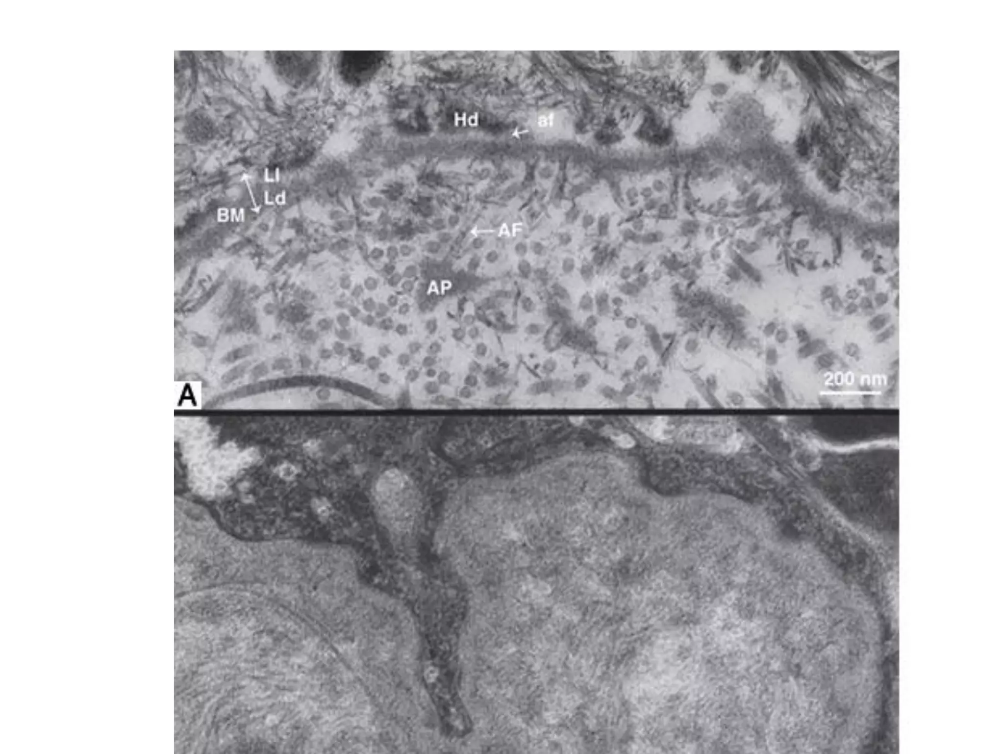 Bullous lesions.pdf
