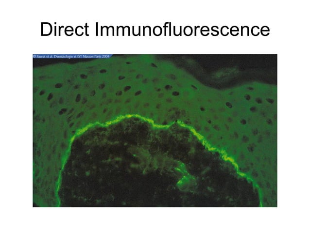Bullous lesions.pdf