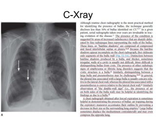Approach to Bullous lung disease | PPT