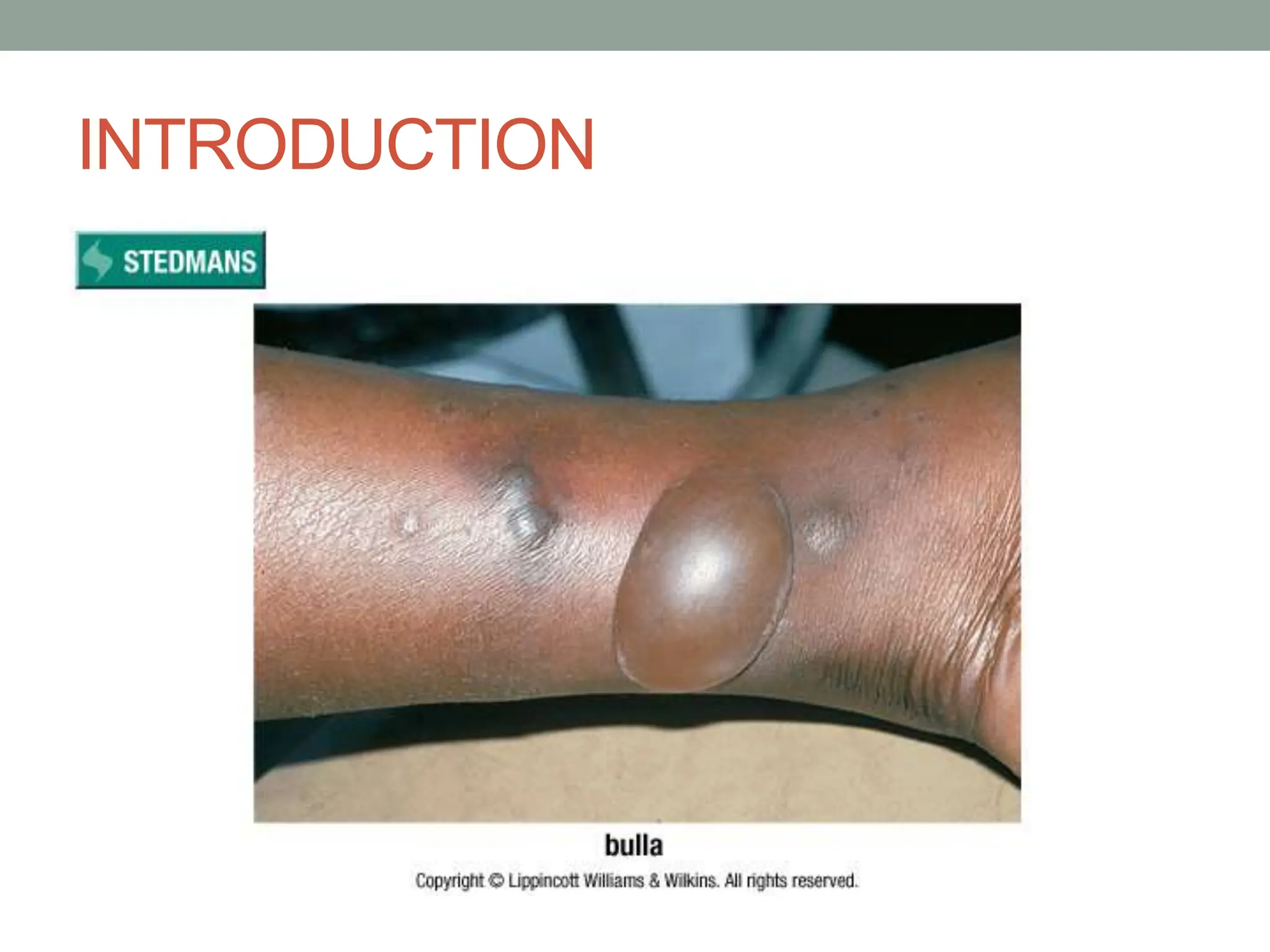 BULLOUS SKIN DISORDERS.ppt