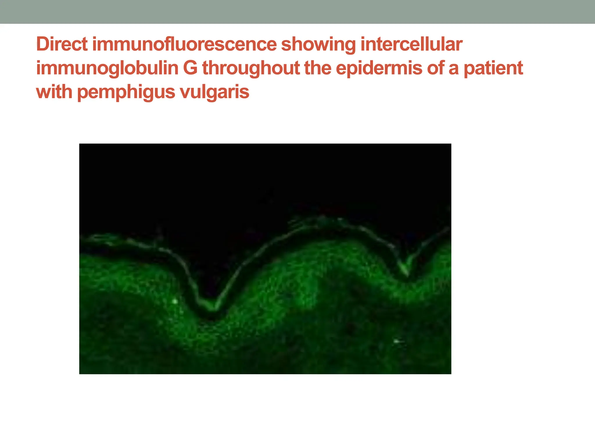 BULLOUS SKIN DISORDERS.ppt | Skin and Dermatology | Diseases and Conditions