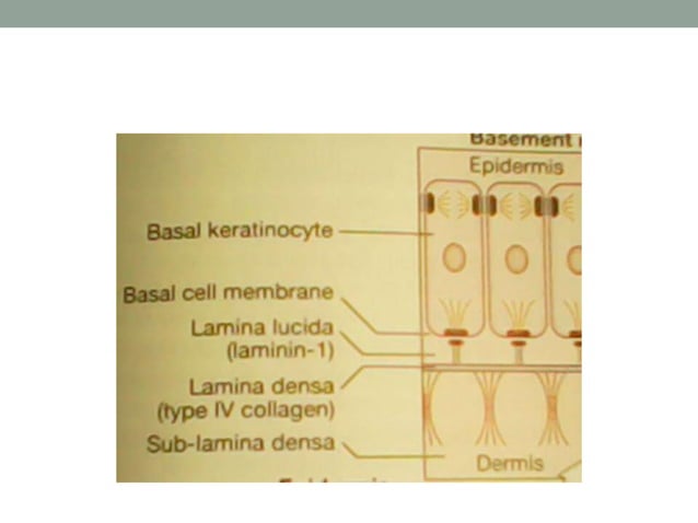 BULLOUS SKIN DISORDERS.ppt | Skin and Dermatology | Diseases and Conditions