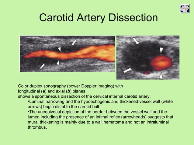 Bedside Ultrasound in Neurosurgery Part 2/3 | PPT