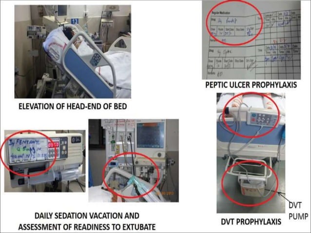 Bundle care | PPTX | First Aid | Injuries