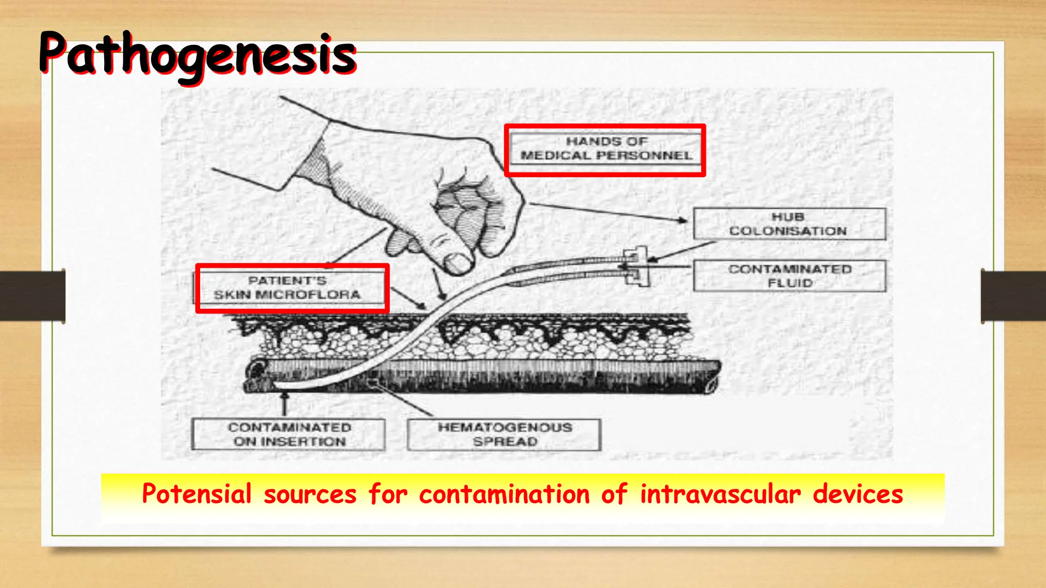 BUNDLES HAIS PENCEGAHAN DAN PENGENDALIAN INFEKSI | PPTX