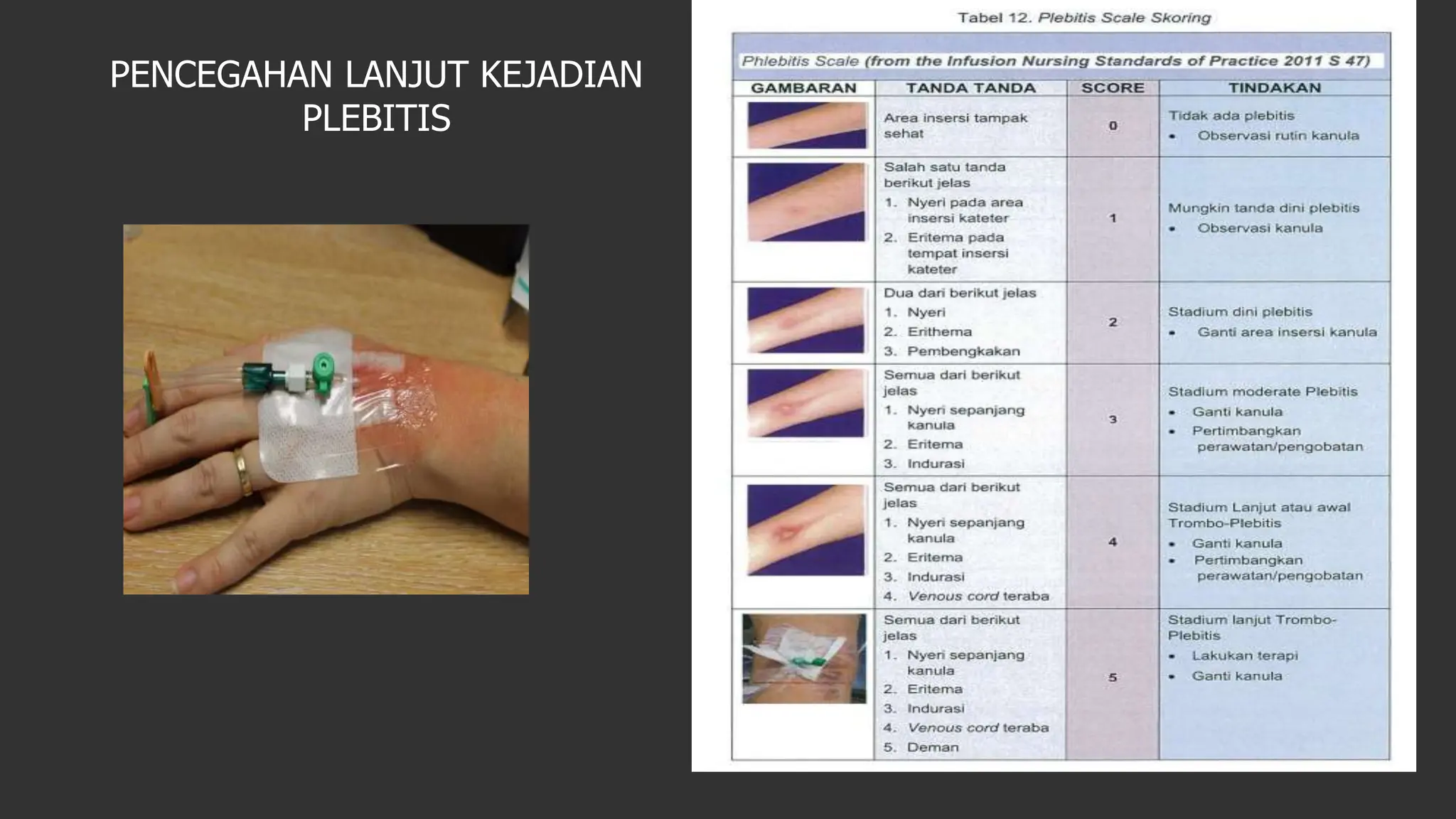 BUNDLES HAIS PENCEGAHAN DAN PENGENDALIAN INFEKSI | PPTX