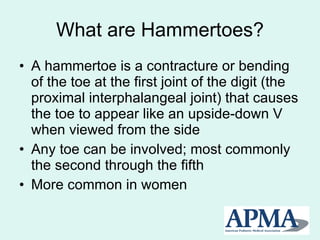 Bunions and Hammertoes: Symptoms and Treatment | PPT | Death, Injury ...