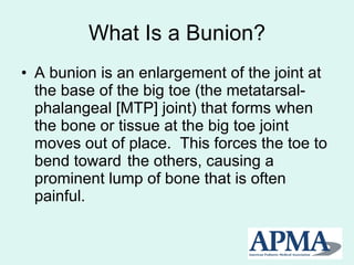 Bunions and Hammertoes: Symptoms and Treatment | PPT