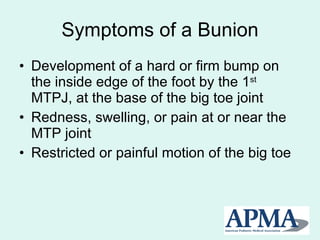 Bunions and Hammertoes: Symptoms and Treatment | PPT | Death, Injury ...
