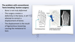 Bunion surgery, Non Bone Breaking Alternative, Syndesmosis Procedure | PPTX