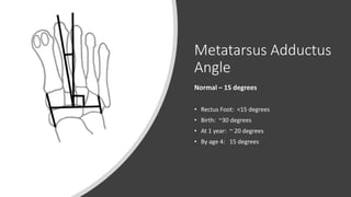 Bunion work - up | PPT