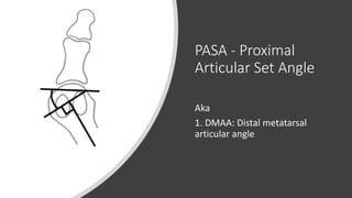 Bunion work - up | PPT