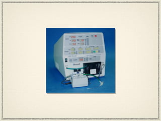 Bunnell History and High Frequency Jet Ventilator Theory | PDF