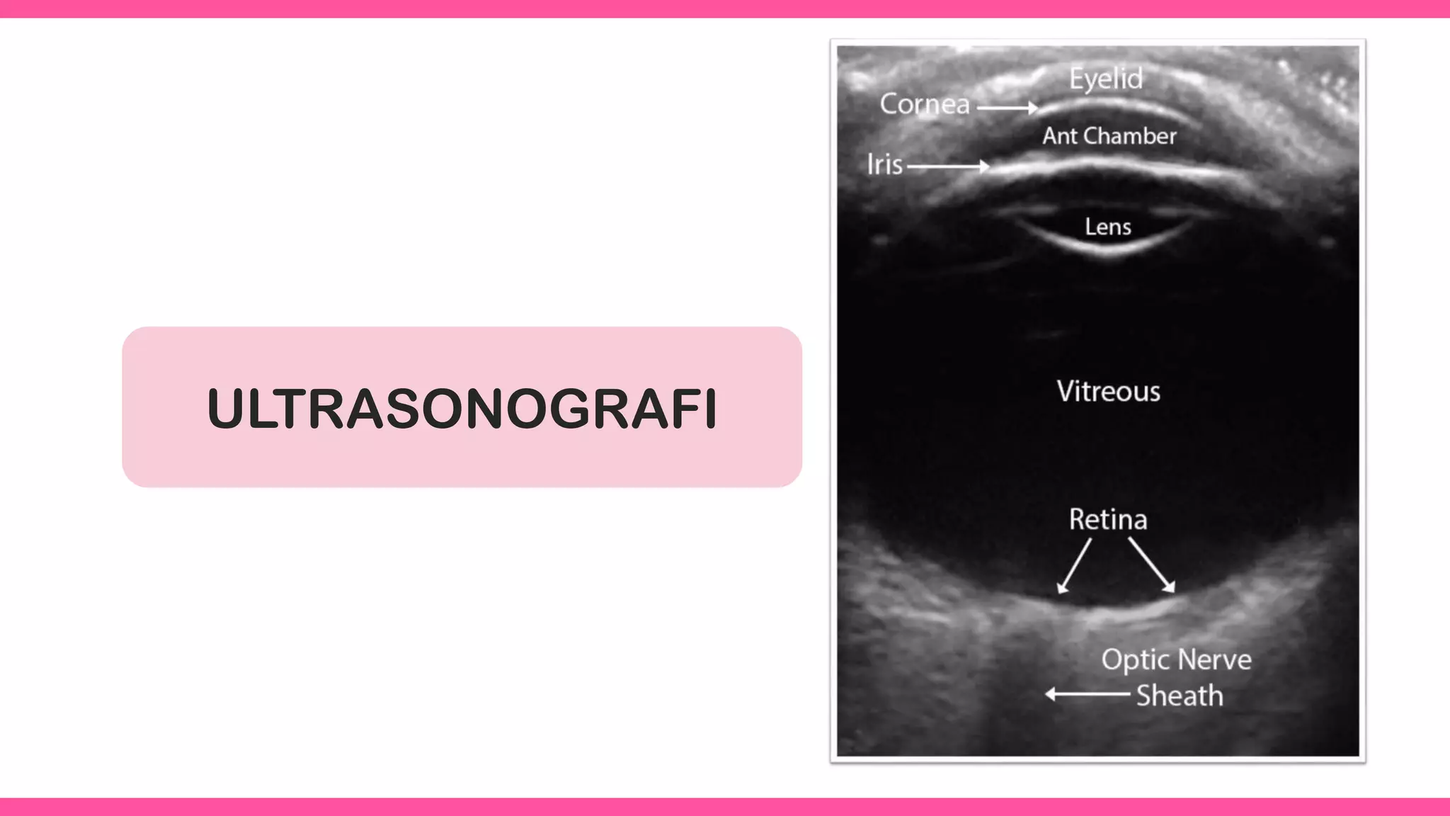 Buook reading retiina | PPTX