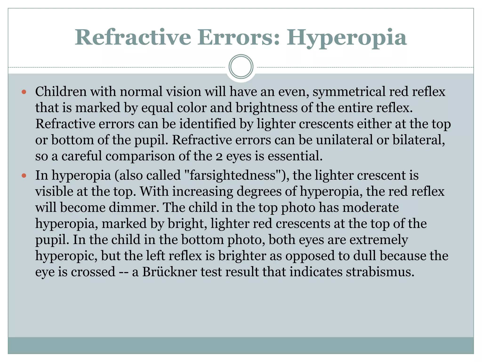 Burckner test or red reflex test | PPTX