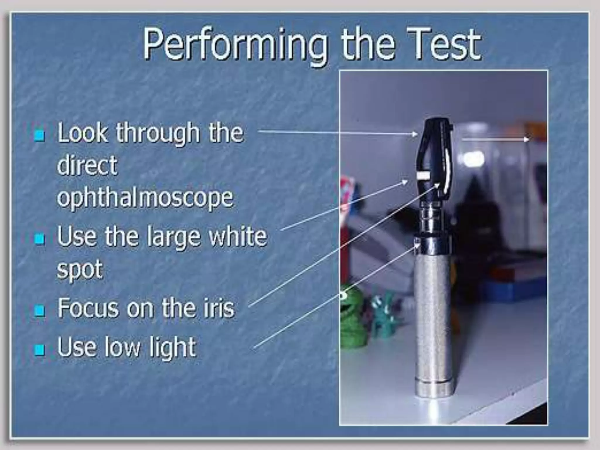 Burckner test or red reflex test | PPTX