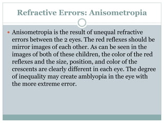 Burckner test or red reflex test | PPTX