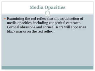 Burckner test or red reflex test | PPTX