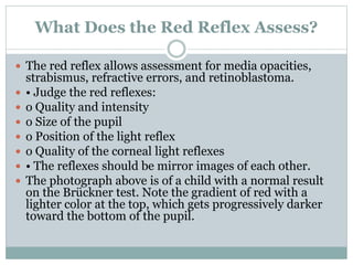 Burckner test or red reflex test | PPTX