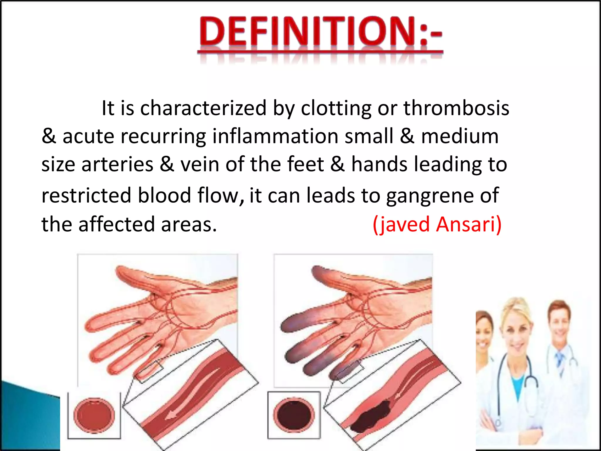 Burger disease | PPTX