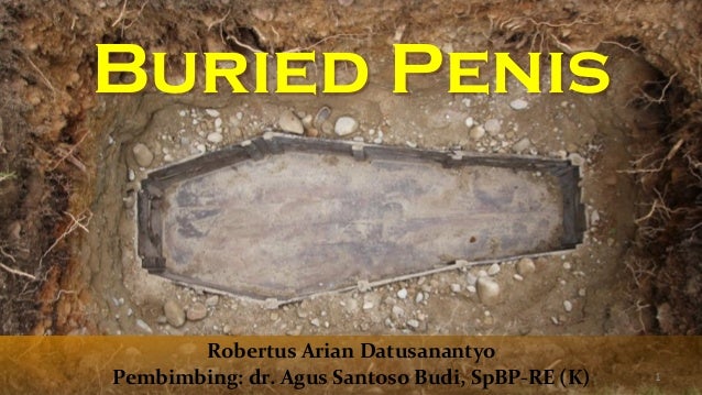 Buried Penis | PDF