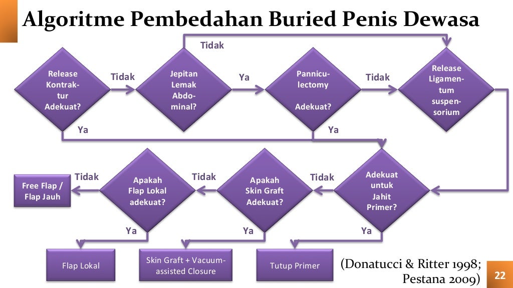 Buried Penis | PDF