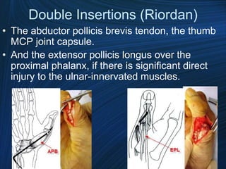 Burkhalter's Procedure | PDF