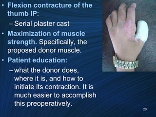 Burkhalter's Procedure | PDF