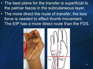 Burkhalter's Procedure | PDF