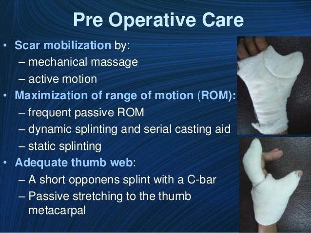 Burkhalter's Procedure
