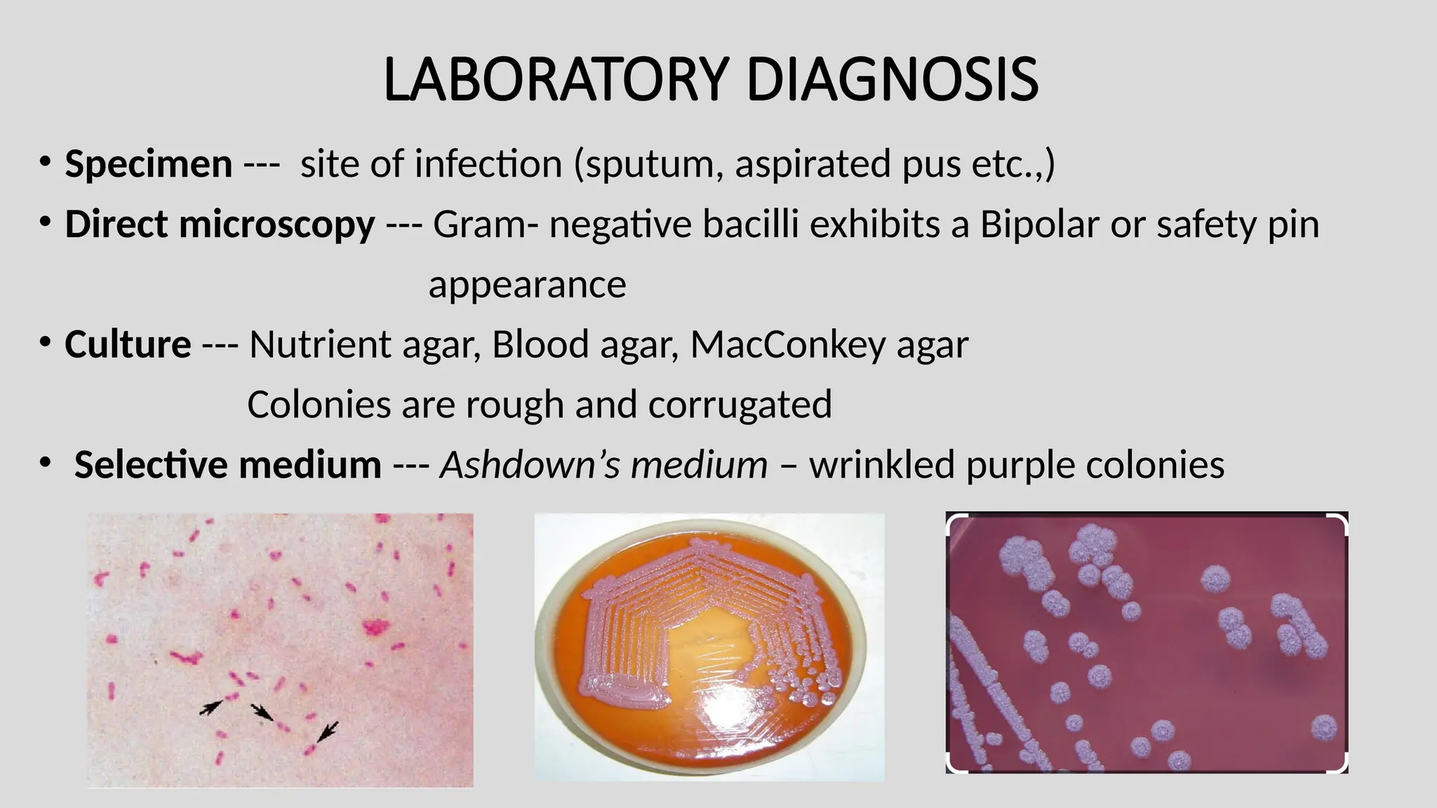 BURKHOLDERIA-1.pptx - Microbiology 2 nd year MBBS | PPTX