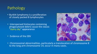 BURKITTS LYMPHOMA.pptx