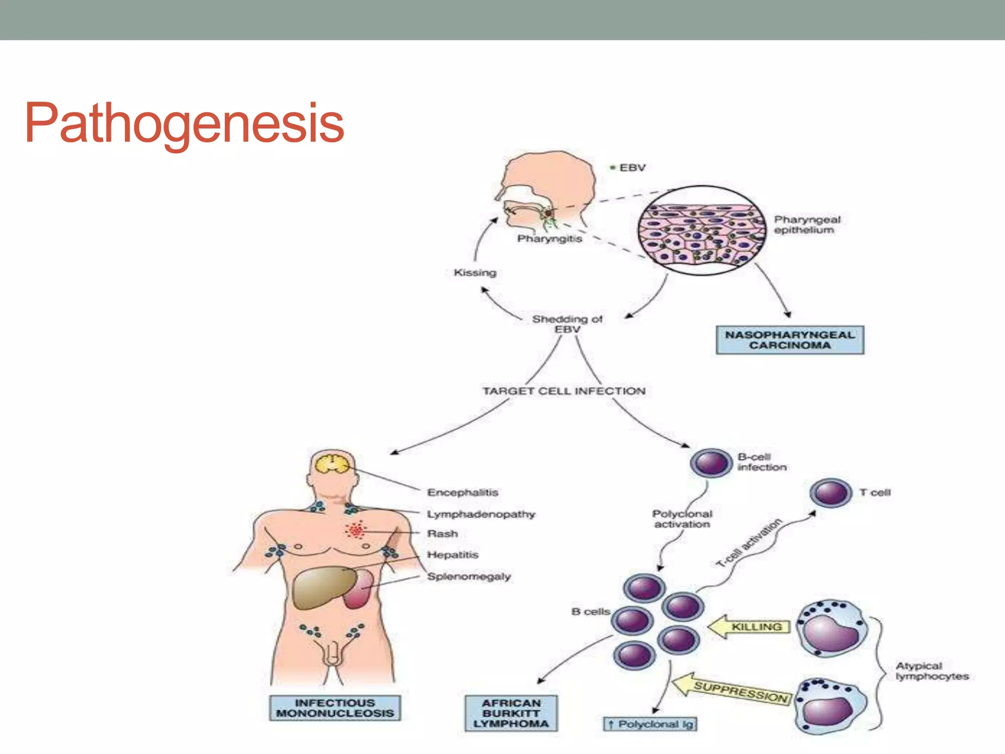 Burkitts lymphoma and abdominal masses | PPTX