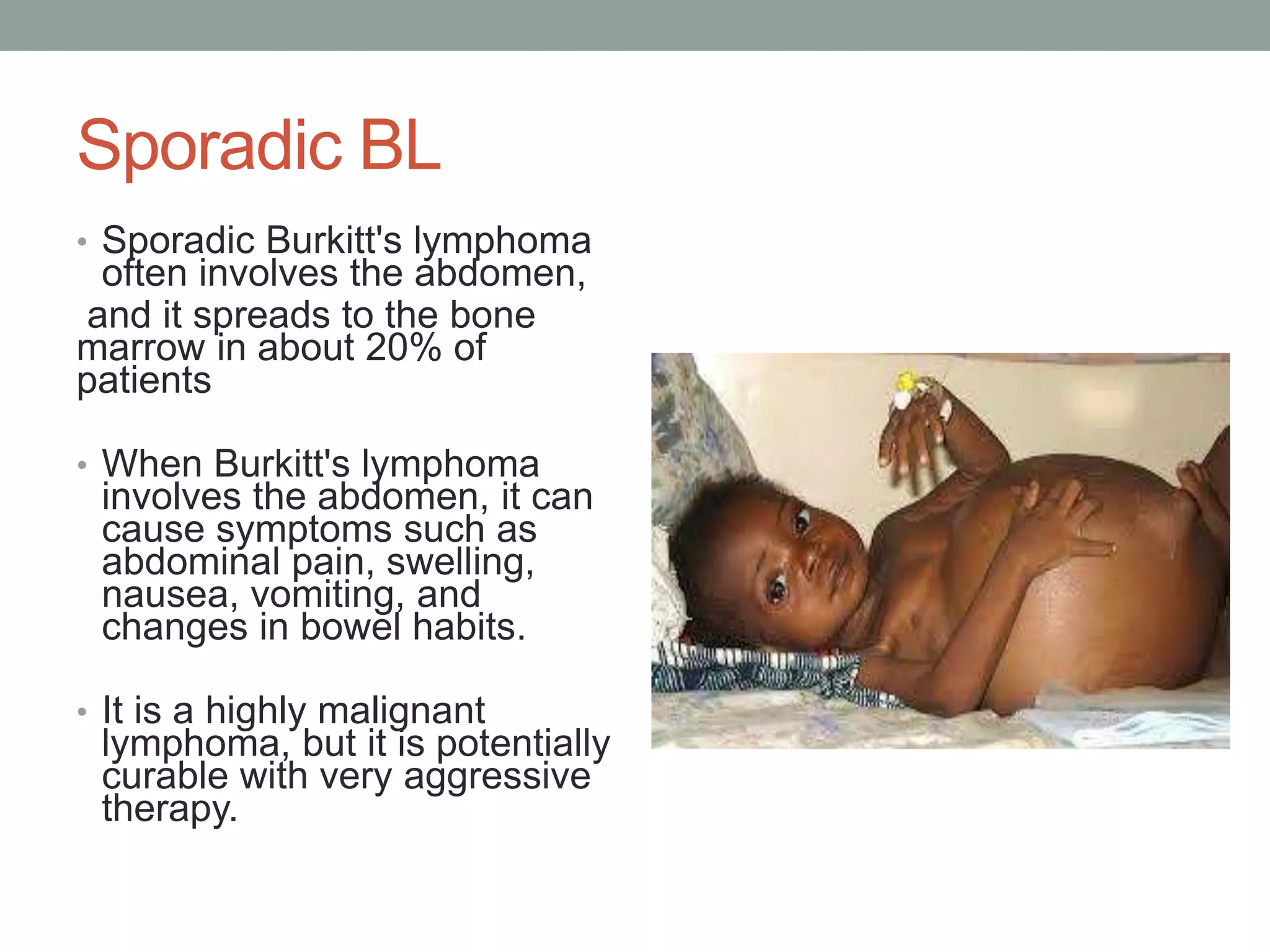 Burkitts lymphoma and abdominal masses | PPTX