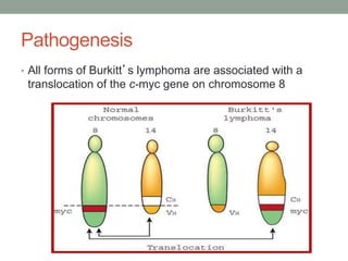 Burkitts lymphoma and abdominal masses | PPT